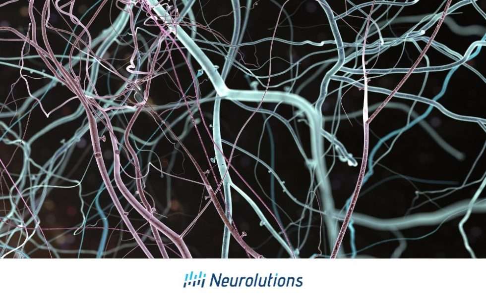 Brain Plasticity: Understanding the Brain’s Ability to Heal and Adapt after Stroke - Neurolutions